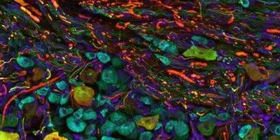 Image of the Day: Bat Brains | The Scientist