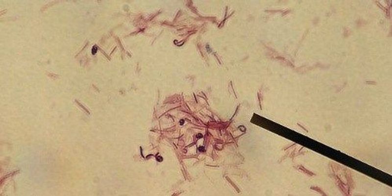 How a Popular Probiotic Works | The Scientist