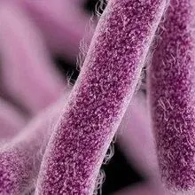 Image of the Day: Sickening Shigella | The Scientist