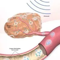 Radiation | The Scientist