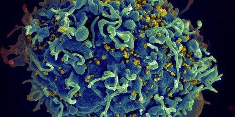 HIV Quickly Invades the Brain | The Scientist