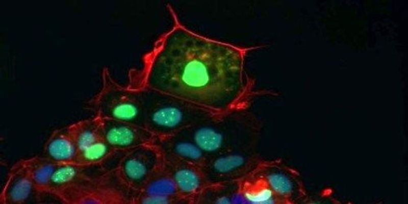 Image of the Day: Leader Cells | The Scientist