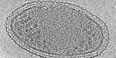 Image of the Day: Ultra-Small Life | The Scientist