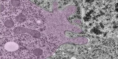 Image of the Day: Cell Invasion | The Scientist