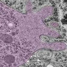 Image of the Day: Cell Invasion | The Scientist