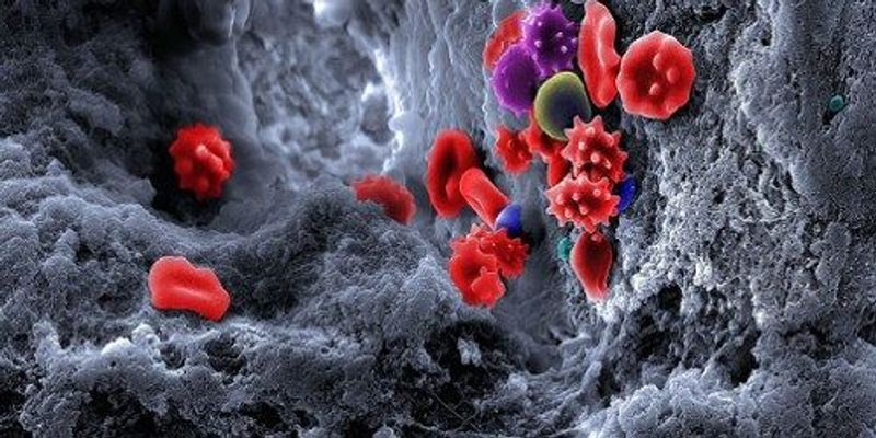 Image of the Day: Clot Capture | The Scientist