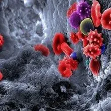 Image of the Day: Clot Capture | The Scientist