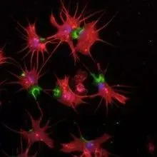 Image of the Day: Snail Blood | The Scientist