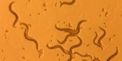 Filming the Nematode Brain | The Scientist