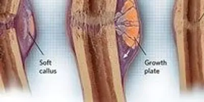 Straighten Out | The Scientist