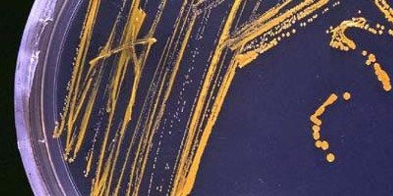 Imagining a “World Without Microbes” | The Scientist