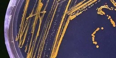 Imagining a “World Without Microbes” | The Scientist