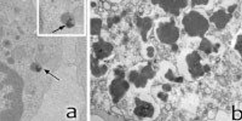 Uncommonly Rare | The Scientist