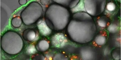 Next Generation: Fat-Targeted Gene Knockdown | The Scientist