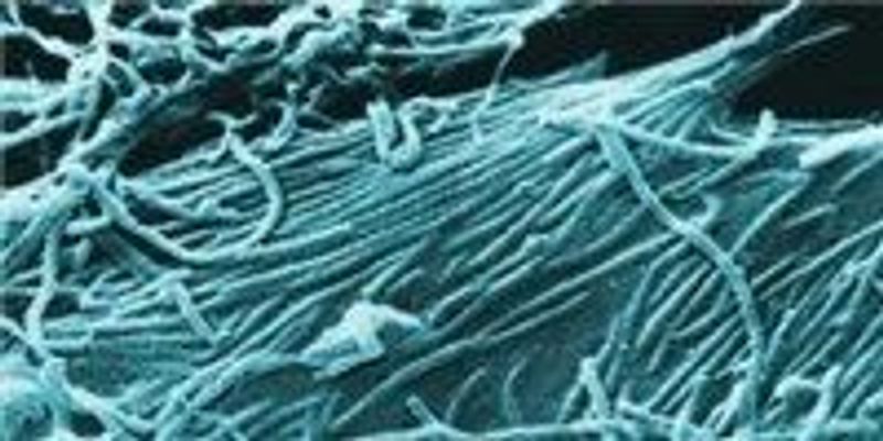 CDC Director: First U.S. Ebola Case a “Teachable Moment” | The Scientist