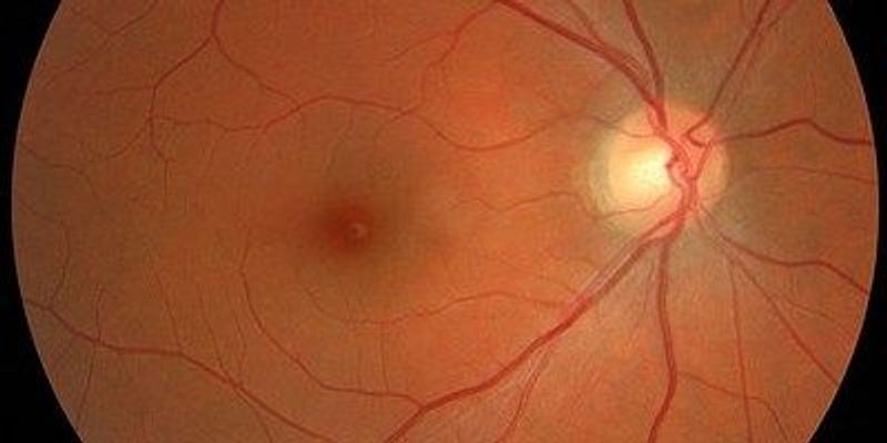 Stem Cell Trial for Eye Disease Commences | The Scientist