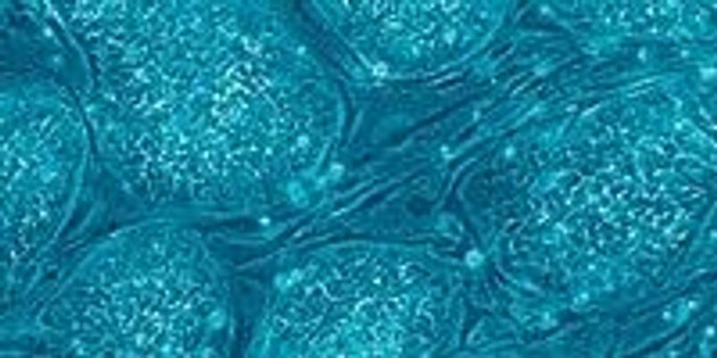 Banking on iPSCs | The Scientist