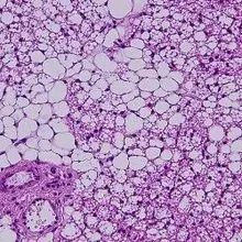 Markers Distinguish “Good” from “Bad” Fat | The Scientist