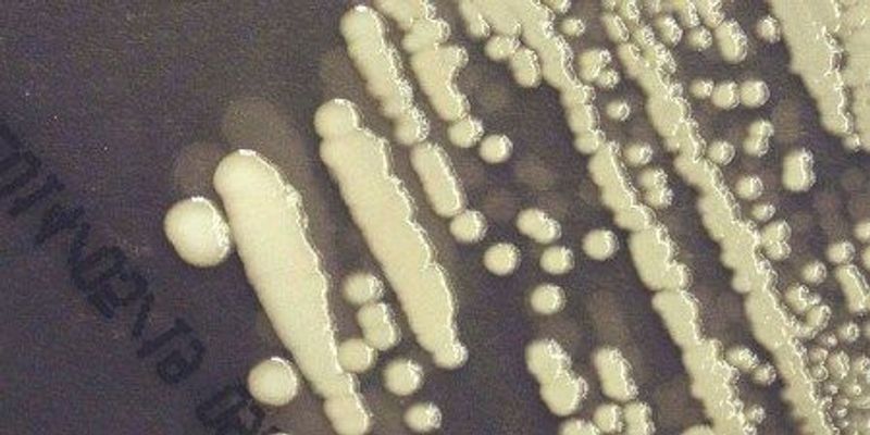 CDC Anthrax Researcher Resigns | The Scientist