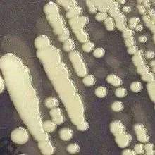 CDC Anthrax Researcher Resigns | The Scientist