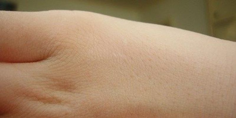 Human Skin Can “Smell” Odors | The Scientist