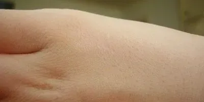 Human Skin Can “Smell” Odors | The Scientist