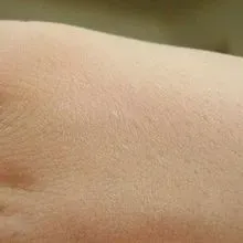 Human Skin Can “Smell” Odors | The Scientist