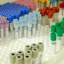 Banking on iPSCs | The Scientist