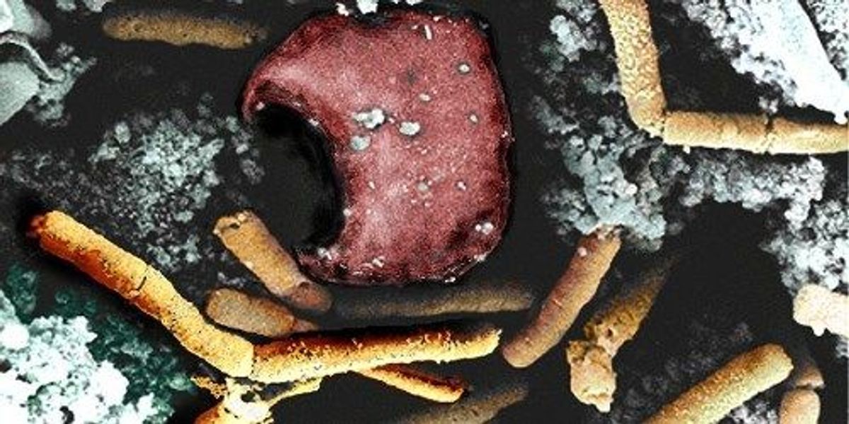 Anthrax Disease Cell