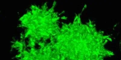Protein Clumps Spread Inflammation | The Scientist