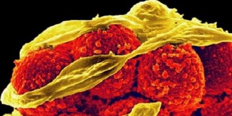 Image of the Day: Murderous Microbe | The Scientist Magazine®