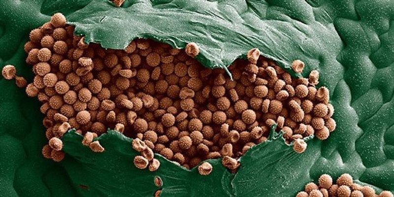 Image of the Day: Pathogenic Pustule | The Scientist