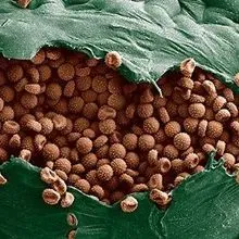 Image of the Day: Pathogenic Pustule | The Scientist