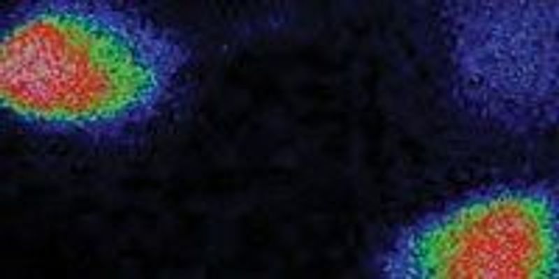 Nutrient-Sensing Neurons | The Scientist