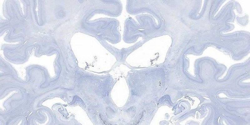 H.M.’s Brain | The Scientist