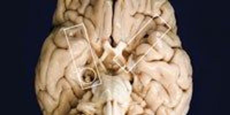 H.M.’s Brain, 1953–Present | The Scientist