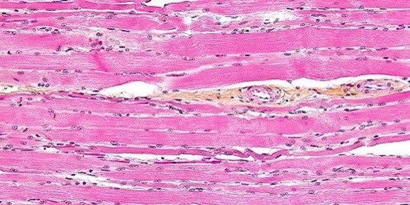 Rebuilding Missing Muscle | The Scientist