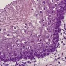 Rats Receive Lab-Grown Esophagi | The Scientist