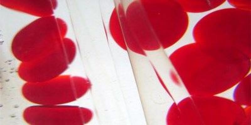 Artificial Blood Is Patient-Ready | The Scientist