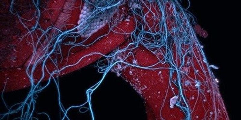Image of the Day: Tangled Web | The Scientist