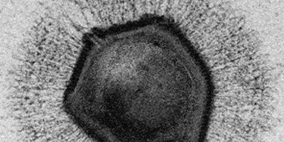 Ancient Giant Virus Discovered | The Scientist