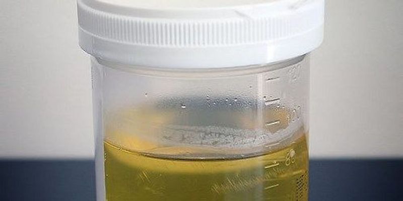 Paper-Based Cancer Test? | The Scientist