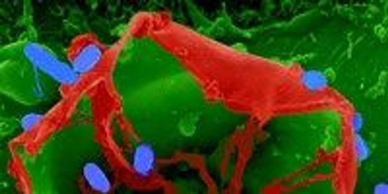 Image of the Day: Invasive Bacteria | The Scientist