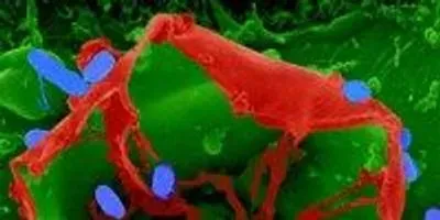 Image of the Day: Invasive Bacteria | The Scientist