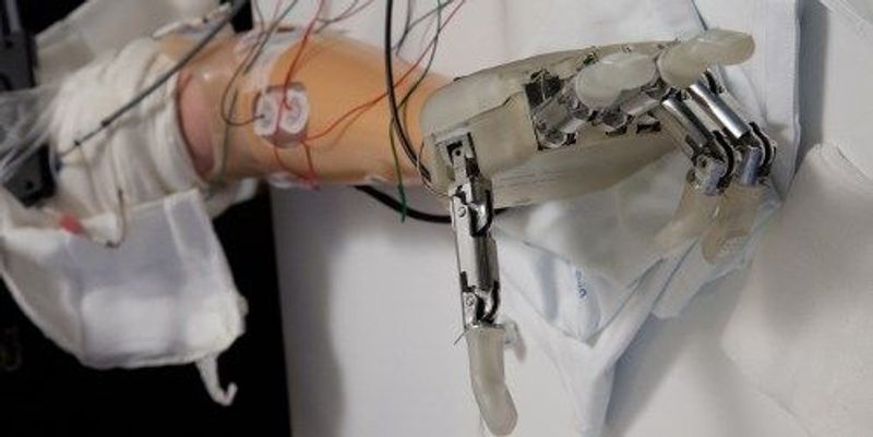 Prosthesis Re-creates Sensation of Touch | The Scientist