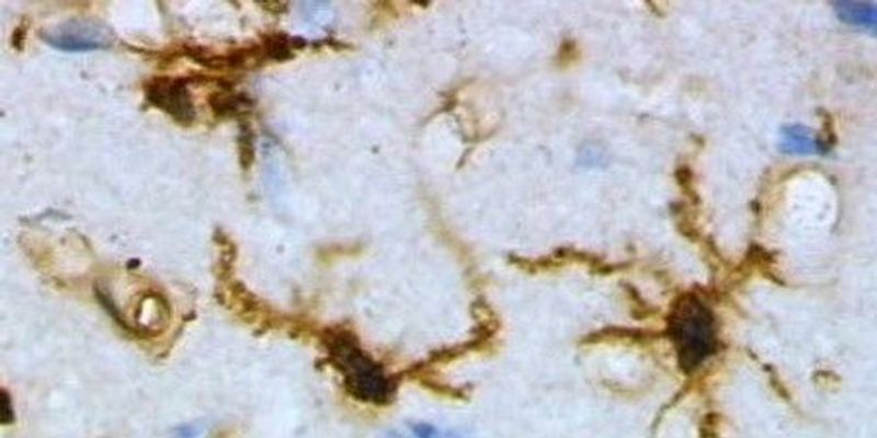 Pruning Synapses Improves Brain Connections | The Scientist