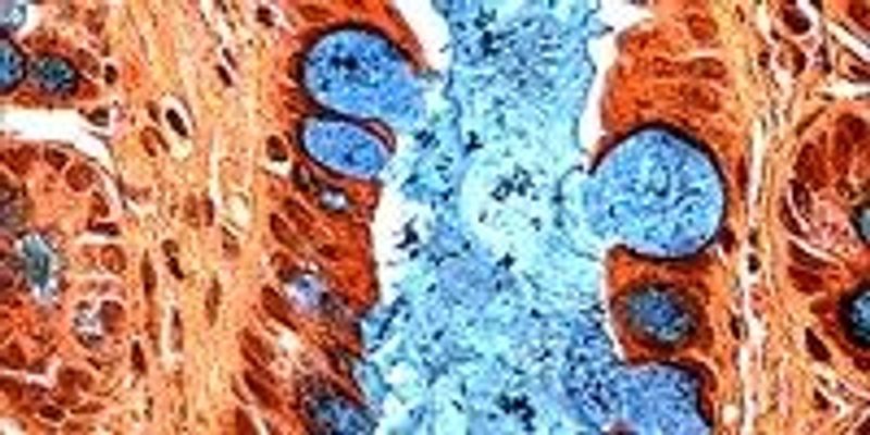 Image of the Day: Abnormal Tissue | The Scientist