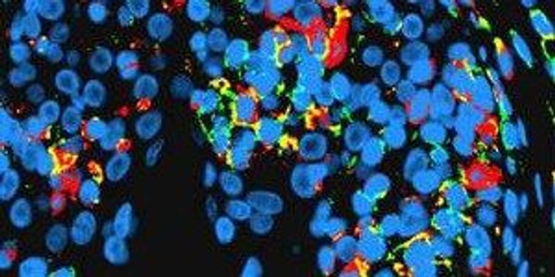 Facing Rejection | The Scientist