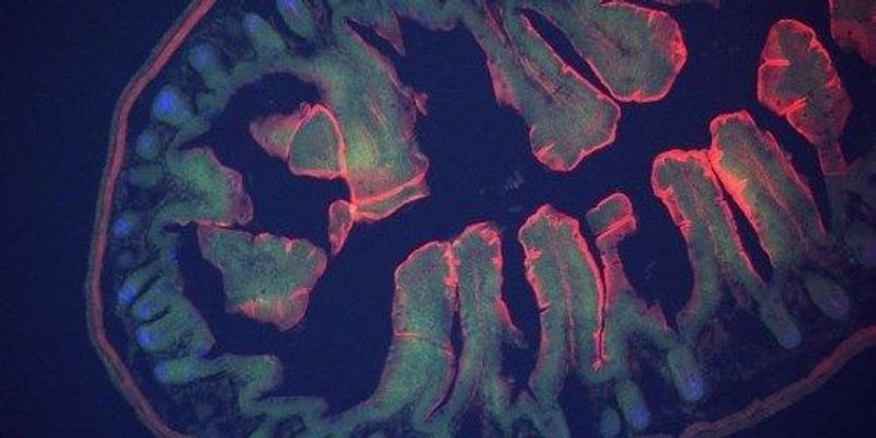 Gut Microbes and Autism | The Scientist