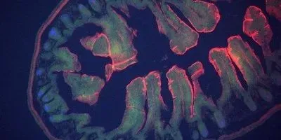 Gut Microbes and Autism | The Scientist